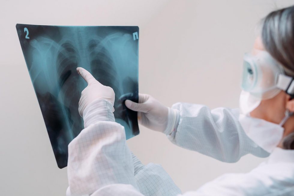 INH (Isonicotinic Acid Hydrazide) & Vitamin B6 | Lifepack.id