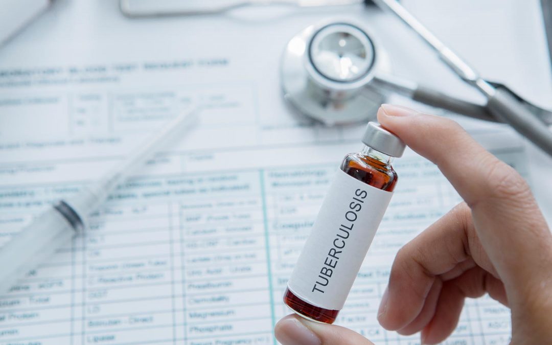 Tuberkulosis: Gejala, Penyebab, Cara Mencegah dan Mengobati | Lifepack.id