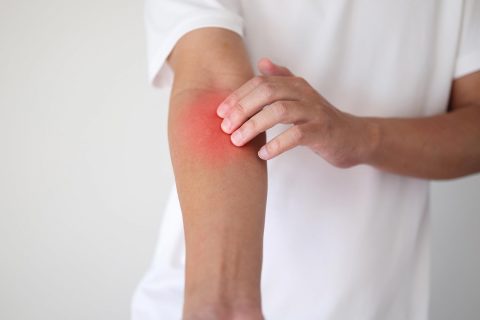 Obat Termisil : Manfaat, Dosis, Efek Samping | Lifepack.id